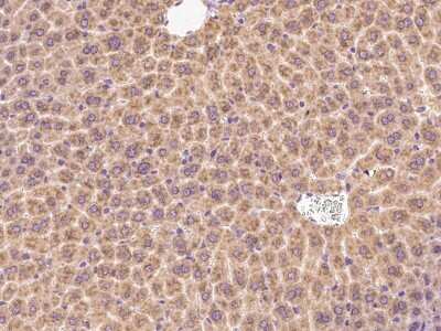 LIN52 Antibody (NBP2-99294): Novus Biologicals
