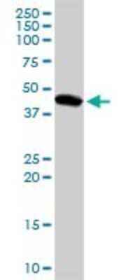 Lefty-1 Antibody (H00010637-D01P): Novus Biologicals