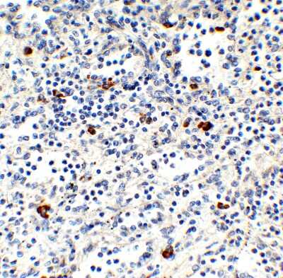 MNDA Antibody - BSA Free (NBP3-18135): Novus Biologicals