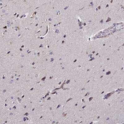 Mrc2 Antibody - BSA Free (NBP1-85768): Novus Biologicals