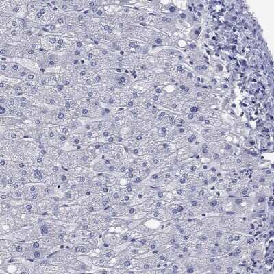 NACAD Antibody - BSA Free (NBP3-17129): Novus Biologicals