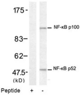 NFkB p100/p52 Antibody (NB100-82063): Novus Biologicals