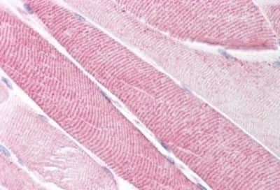 NK2R Antibody - BSA Free (NBP3-14420): Novus Biologicals