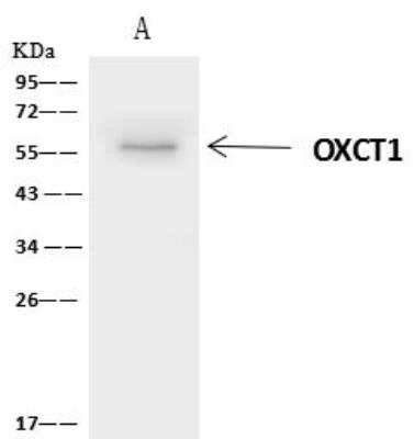 OXCT1 Antibody (NBP2-98535): Novus Biologicals