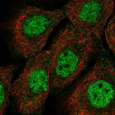 Opsin 3 Antibody (NBP2-55726): Novus Biologicals