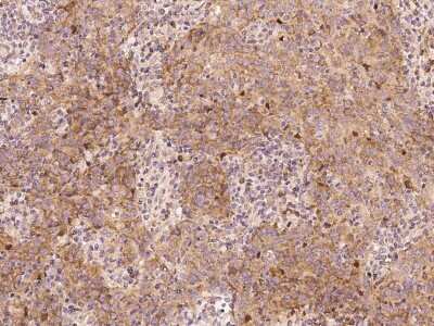 PABP Antibody (NBP2-99378): Novus Biologicals