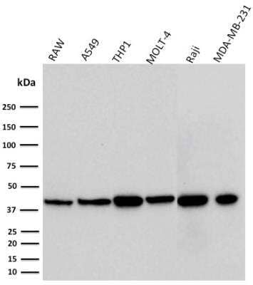 PD-L1 Antibody (PDL1/2746) (NBP2-80490): Novus Biologicals