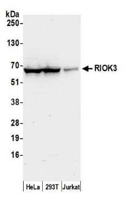 RIOK3 Antibody (NBP2-59129): Novus Biologicals