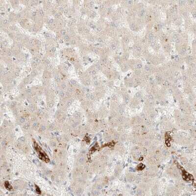 SARM1 Antibody (NBP1-87897): Novus Biologicals