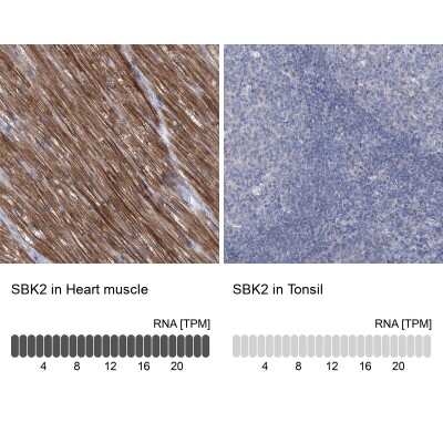 SBK2 Antibody - BSA Free (NBP1-91020): Novus Biologicals