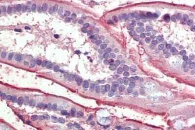 SGLT1/SLC5A1 Antibody (NBP1-52559): Novus Biologicals
