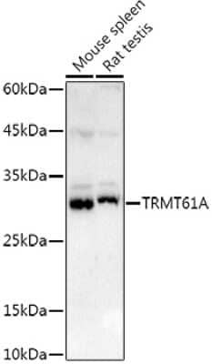 TRMT61A Antibody - BSA Free (NBP2-94200): Novus Biologicals