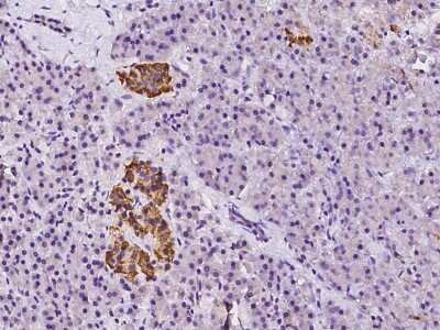 TSPAN3 Antibody (NBP2-98555): Novus Biologicals