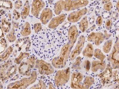 Vanin-1/VNN1 Antibody (NBP2-97301): Novus Biologicals