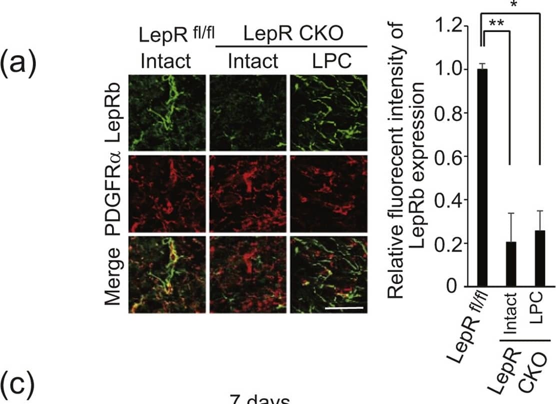 PDGFR alpha Antibodies: Novus Biologicals