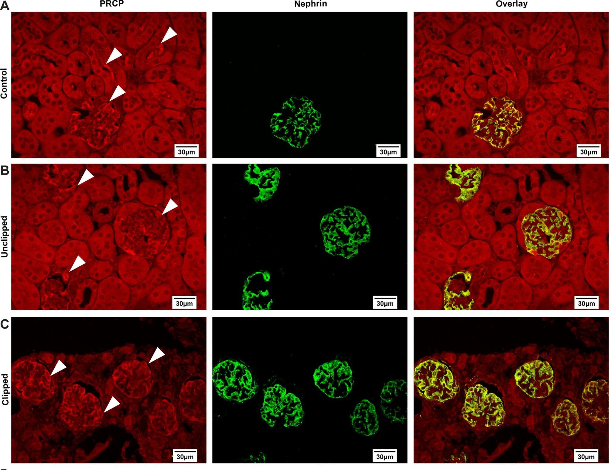 Nephrin Antibody Unconjugated AF3159 Novus Biologicals Nephrin Antibody Unconjugated AF3159 Novus Biologicals