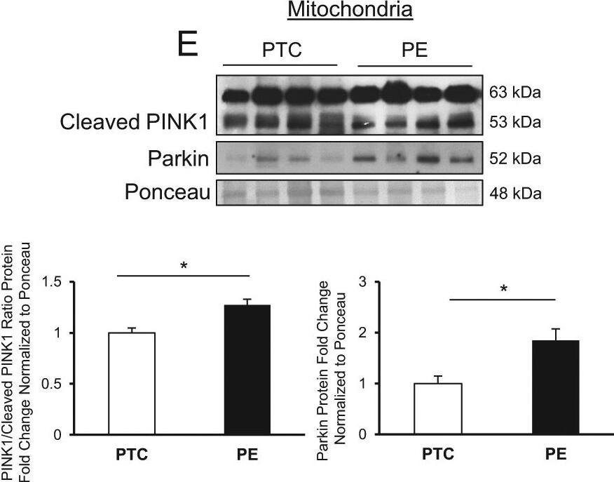 PINK1 Antibody - BSA Free (BC100-494): Novus Biologicals