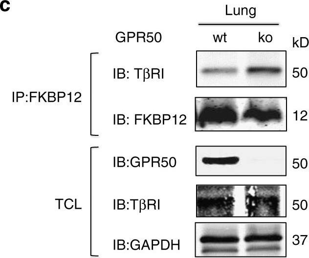 GPR50 Antibody (H00009248-B01P): Novus Biologicals