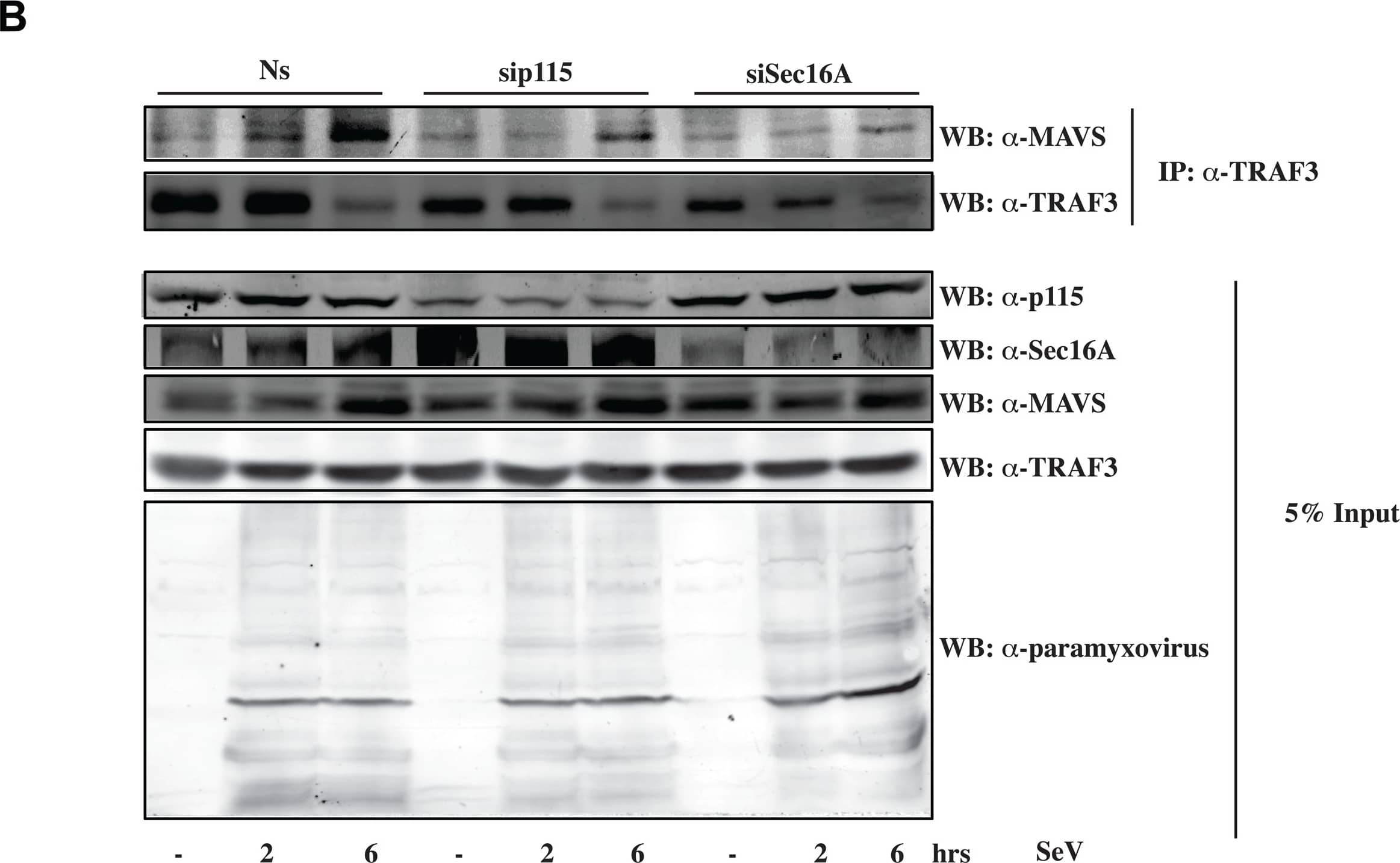 SEC16A Antibody (NB100-1799): Novus Biologicals