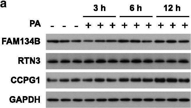 FAM134B Antibody (NBP2-55248): Novus Biologicals