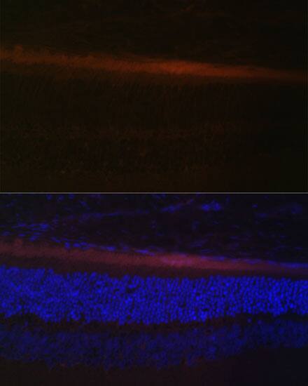 RDH5 Antibody - BSA Free (NBP2-93754): Novus Biologicals