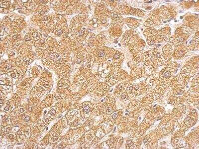11 beta-HSD1 Antibody (NBP1-32027): Novus Biologicals