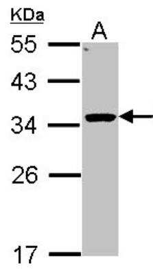 11 beta-HSD1 Research Products: Novus Biologicals