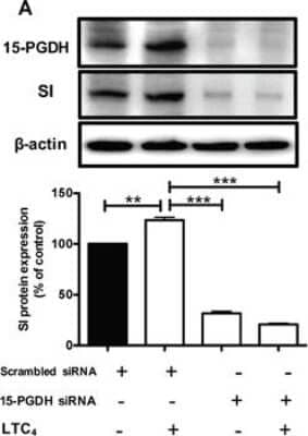 15-PGDH/HPGD Antibody (NB200-179): Novus Biologicals