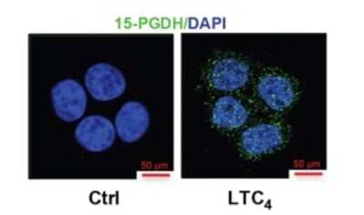 15-PGDH/HPGD Antibody (NB200-179): Novus Biologicals