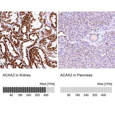 ACAA2 Antibody (NBP1-84974): Novus Biologicals