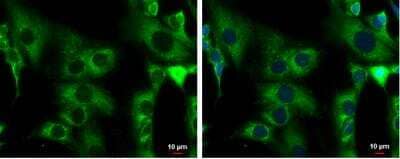 ACADM Antibody (NBP1-31397): Novus Biologicals
