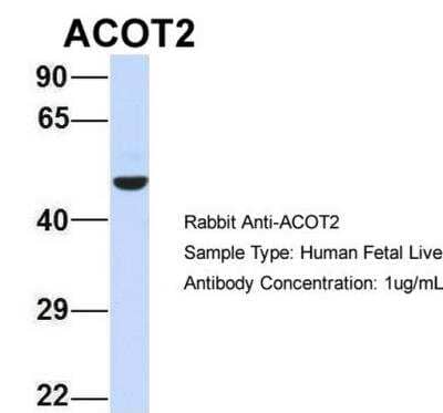 ACOT2 Antibody (NBP1-70402): Novus Biologicals