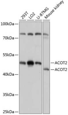 ACOT2 Antibody - Azide and BSA Free (NBP2-92161): Novus Biologicals