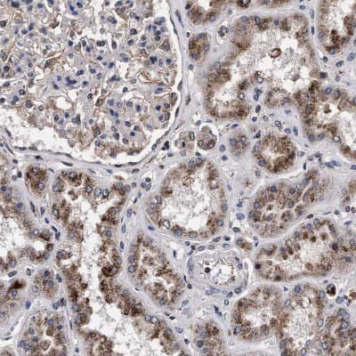 ACOX1 Antibody (NBP1-80951): Novus Biologicals