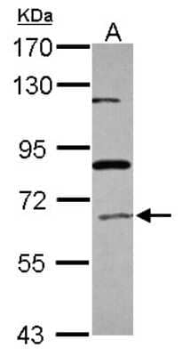 ACOX1 Antibody (NBP2-15249): Novus Biologicals