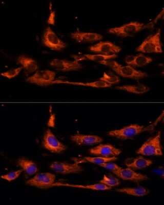 ACOX3 Antibody - Azide and BSA Free (NBP3-15513): Novus Biologicals