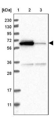 ACSF2 Antibody (NBP2-47558): Novus Biologicals