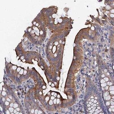 ACSM3 Antibody (NBP1-87098): Novus Biologicals