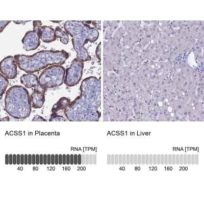 ACSS1 Antibody (NBP2-30612): Novus Biologicals