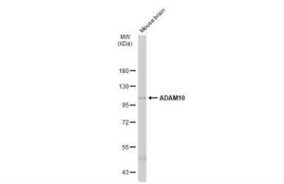ADAM10 Antibodies: Novus Biologicals
