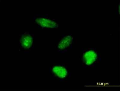 AFF4 Antibody (H00027125-B01P): Novus Biologicals