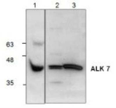 ALK-7/Activin Receptor Type 1C Antibody (NBP1-50659): Novus Biologicals