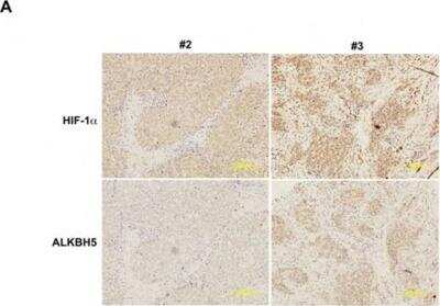 ALKBH5 Antibody (NBP1-82188): Novus Biologicals