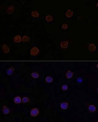 ANO2 Antibody (NBP2-92888): Novus Biologicals