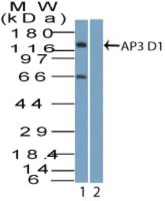 AP3M1 Antibody [Biotin] (NBP1-76589B): Novus Biologicals