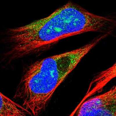 ARMC9 Antibody (NBP1-88991): Novus Biologicals