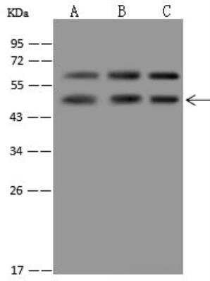 ASB4 Antibody (NBP3-12612): Novus Biologicals
