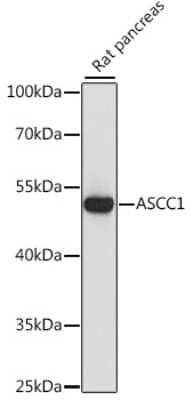 ASCC1 Antibody (NBP2-92631): Novus Biologicals
