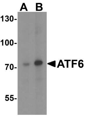ATF6 Antibodies: Novus Biologicals