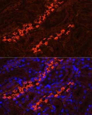 ATP6V1B1 Antibody (NBP2-92479): Novus Biologicals